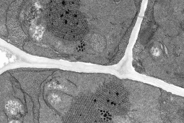 High quality silicon nitride window for TEM丨TEM Grids - Harbor Semi